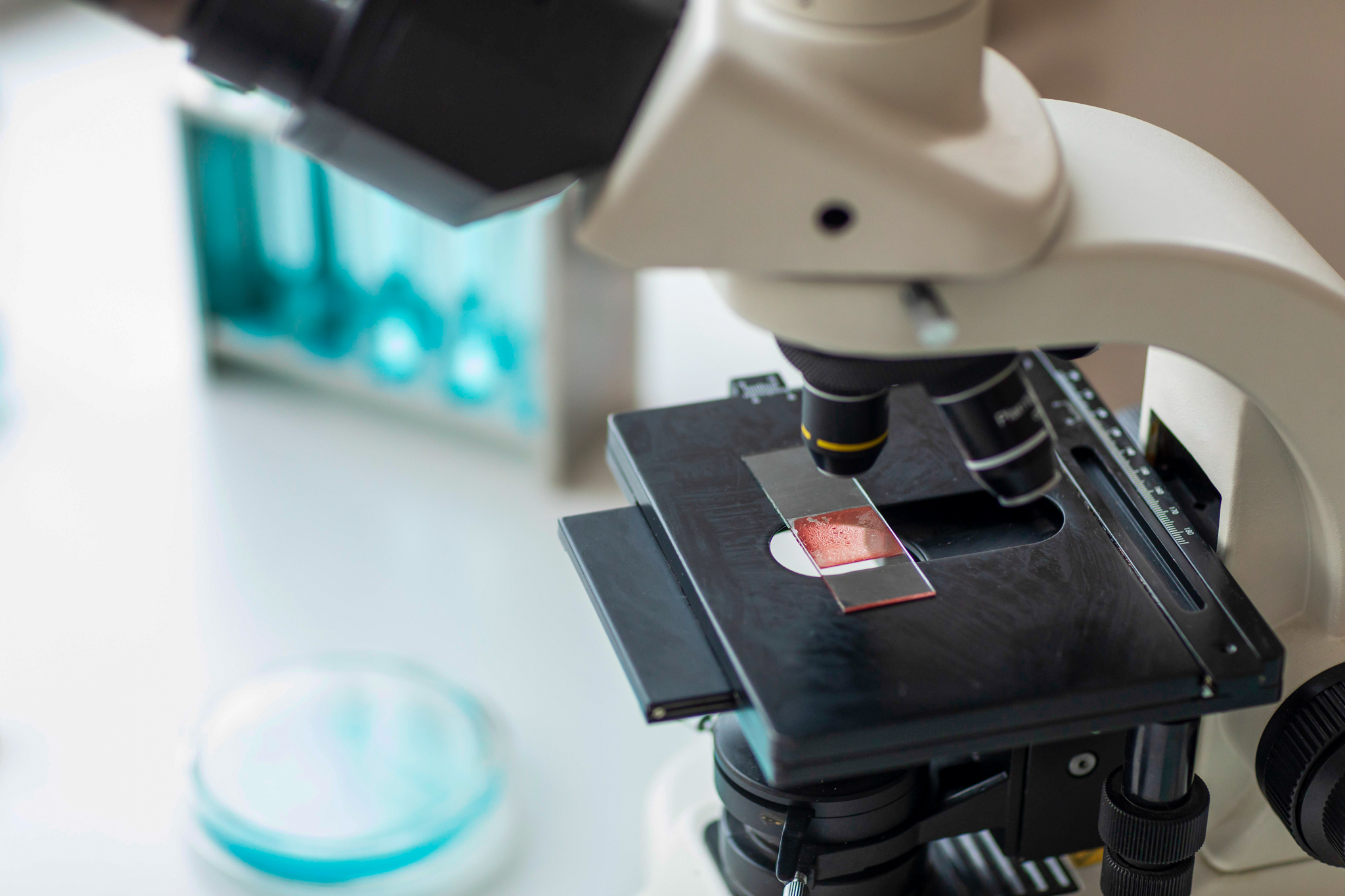 Genetic Health Assessment - Prinz Healthcare