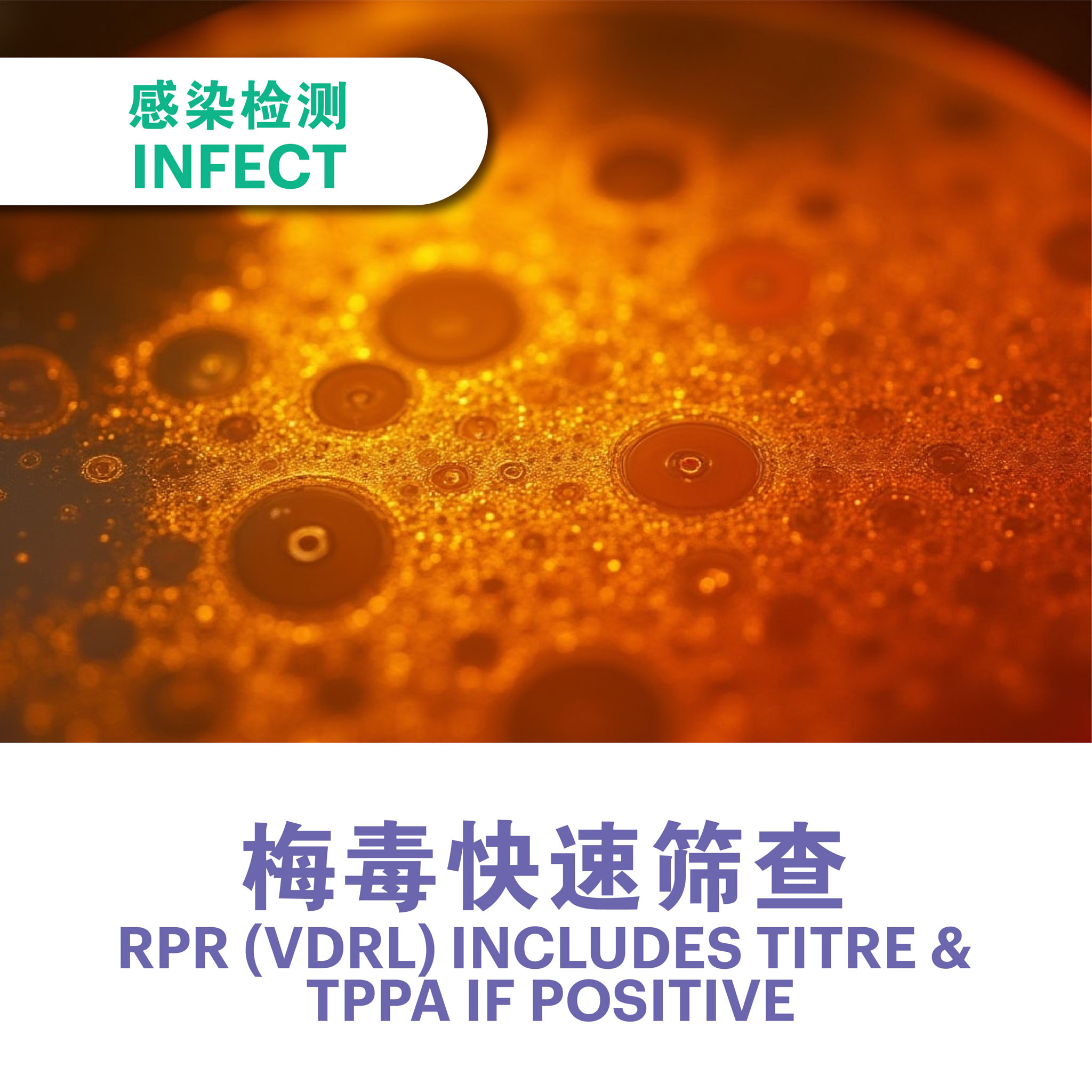 RPR Test | Syphilis Rapid Screening & Treatment Monitoring - Prinz ...